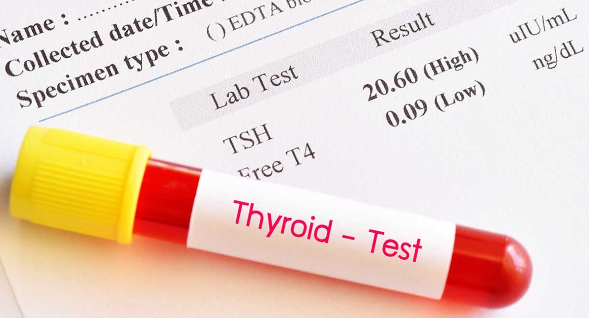 Why You Need A Thyroid Blood Test Biocity Healthcare